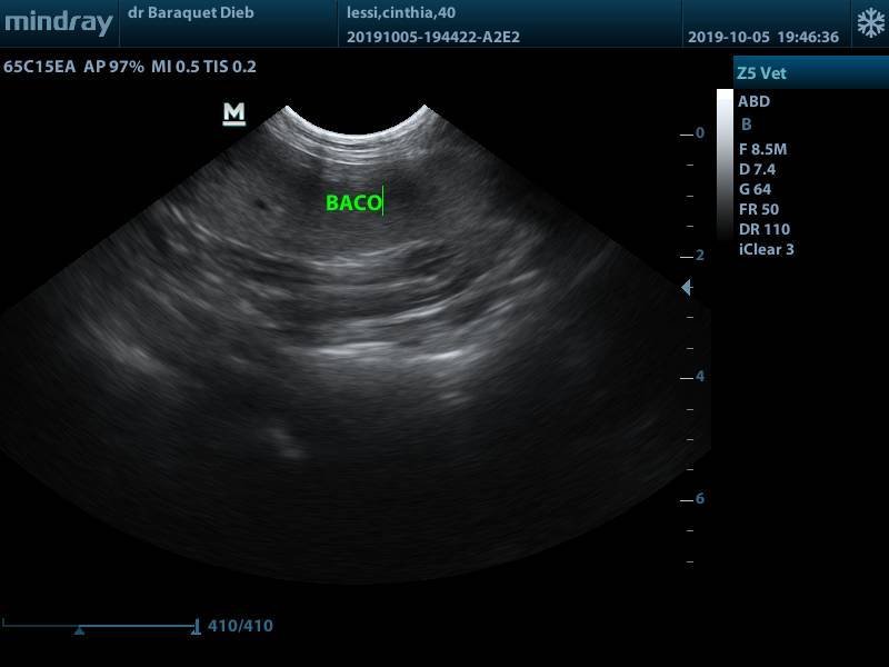 Nódulo chegou ao rim - aguardamos biópsia | Vaquinhas online
