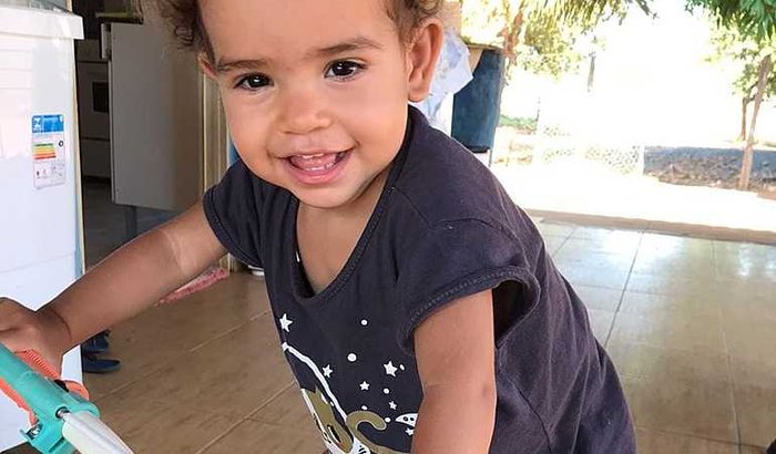 Ajuda para Maria Julia diag. com Mega Cólon-Obstrução intestinal ...