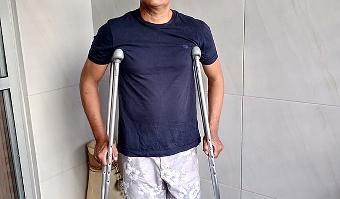 COMPRA DE UMA PRÓTESE MECÂNICA TRANSFEMORAL DA PERNA ESQUERDA ...