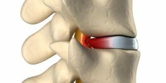 Me ajudem com o tratamento da minha coluna | Vaquinhas online