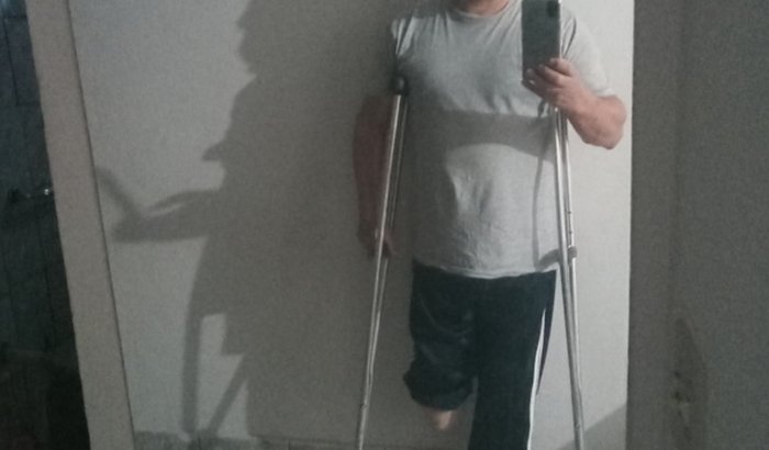 Prótese da perna esquerda | Vaquinhas online