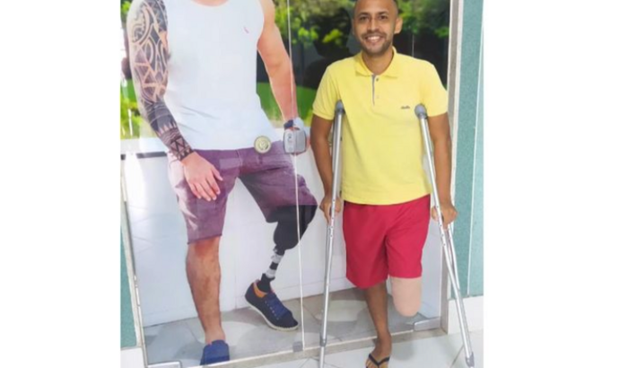 AJUDE A COMPRAR UMA PRÓTESE PARA MIM- PERDI MINHA PERNA ESQUERDA ...