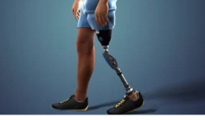 Prótese para perna esquerda | Vaquinhas online