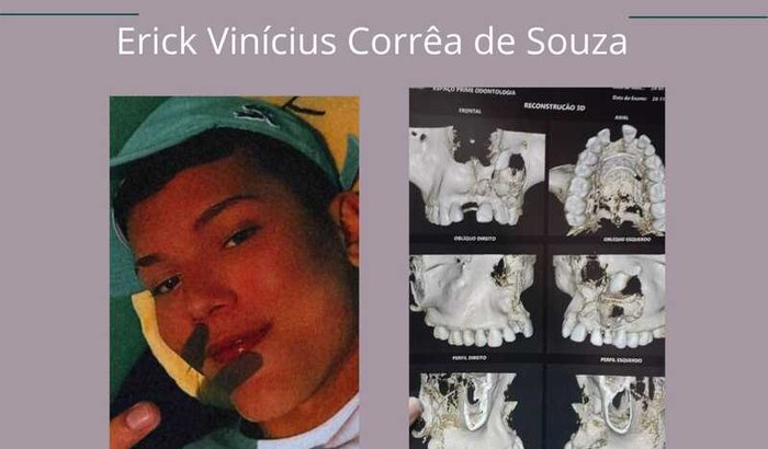 Todos pela saúde do Erick Vinicius | Vaquinhas online