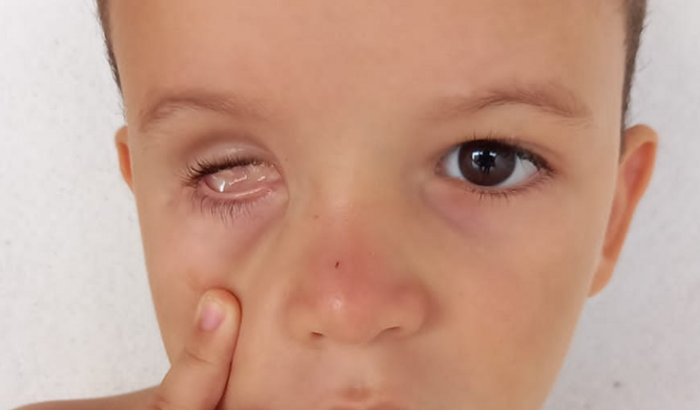 Olho de Vidro | Vaquinhas online