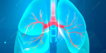 Biópsia pulmonar por radiologia intervencionista | Vaquinhas online