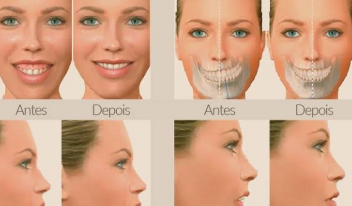 Cirurgia de buco maxilo facial | Vaquinhas online