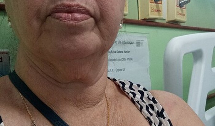 Tratamento dos olhos. | Vaquinhas online