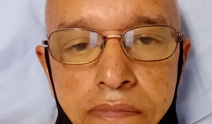 tratamento de neoplasia maligna no estomago e tórax | Vaquinhas online