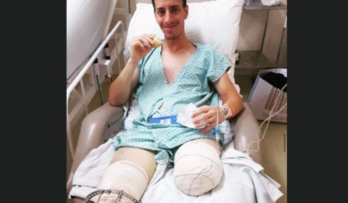 Compra da Prótese da Perna esquerda do Pedro. | Vaquinhas online