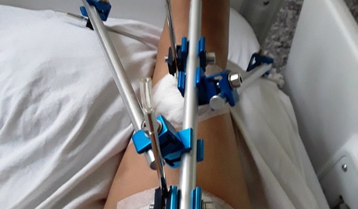 Me ajude a andar de novo | Vaquinhas online