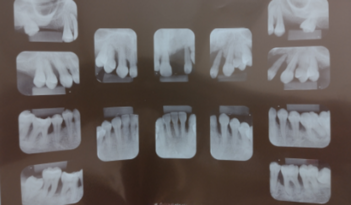 Ajude no tratamento da Yully | Vaquinhas online