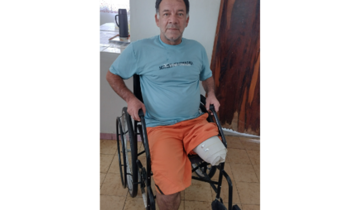 Prótese mecânica para perna | Vaquinhas online