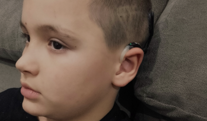 Ajuda para concertar o aparelho de Implante Coclear do meu filho Yago ...