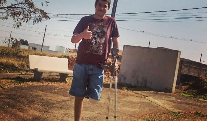 Ajuda para compra da prótese da perna esquerda | Vaquinhas online