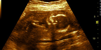 Enxoval da Isabella ♡ | Vaquinhas online