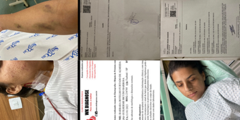 Tratamento de mola invasora - Neoplasia Trofoblástico Gestacional ...