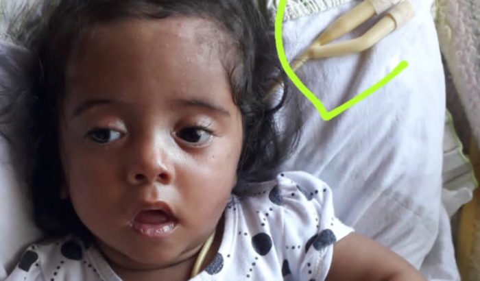 Curativo para sonda da Maria | Vaquinhas online