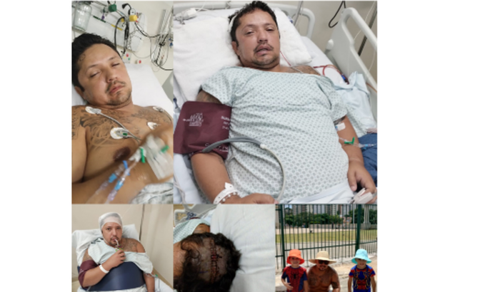 AVC Hemorrágico - Cirurgia e reabilitação | Vaquinhas online