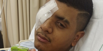 Gean Lucas tem Ceratocone grave e o custo para o tratamento e alto para ...