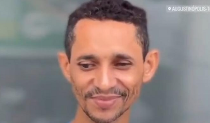 Vaquinha para tratamento de Glaucoma congênito | Vaquinhas online