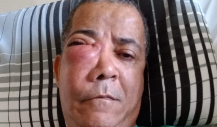 Alimentação, medicamentos, alugél | Vaquinhas online