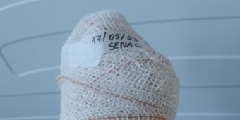 Tratamento de cicatrização de menbro amputado | Vaquinhas online