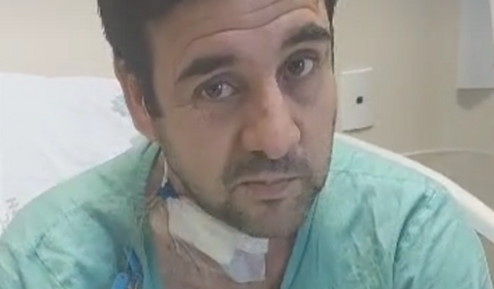Leucemia Mieloide Aguda Doença Rara Que Atinge A Medula óssea