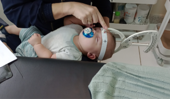 Ajudar Daniel no tratamento da assimetria craniana👶 | Vaquinhas online