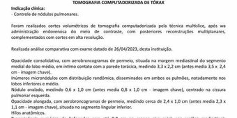 Pleuroscopia/ Retirada e nódulos pulmonares | Vaquinhas online