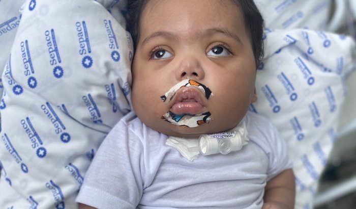 tratamento do dyllan | Vaquinhas online