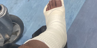 Cirurgia do Tornozelo | Vaquinhas online