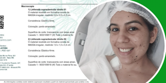 Ajude AQUILA BIANCA na LUTA CONTA O LINFOMA | Vaquinhas online