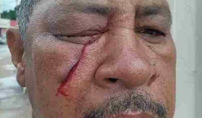 Cirurgia de Adão Lima | Vaquinhas online