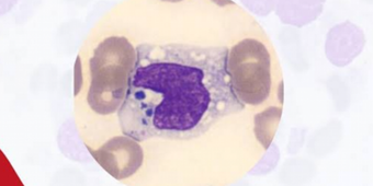 Ajudar nas despesas da Lavínia durante o tratamento | Vaquinhas online