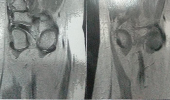 Vaquinha para cirurgia do Joelho | Vaquinhas online
